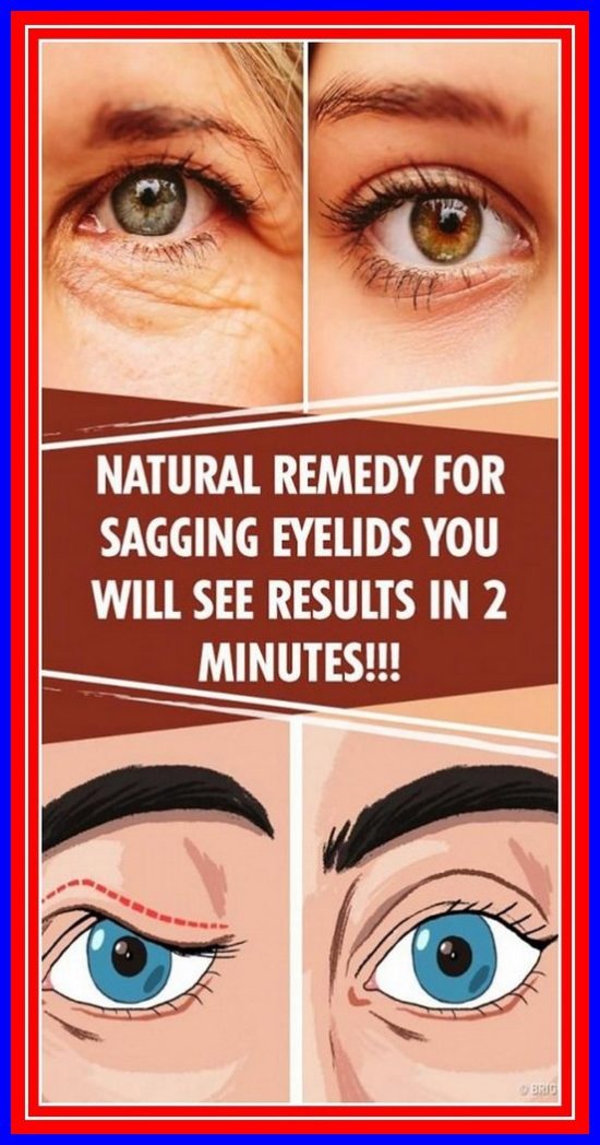Natural Remedy for Sagging Eyelids – You Will See Results in 2 Minutes!
